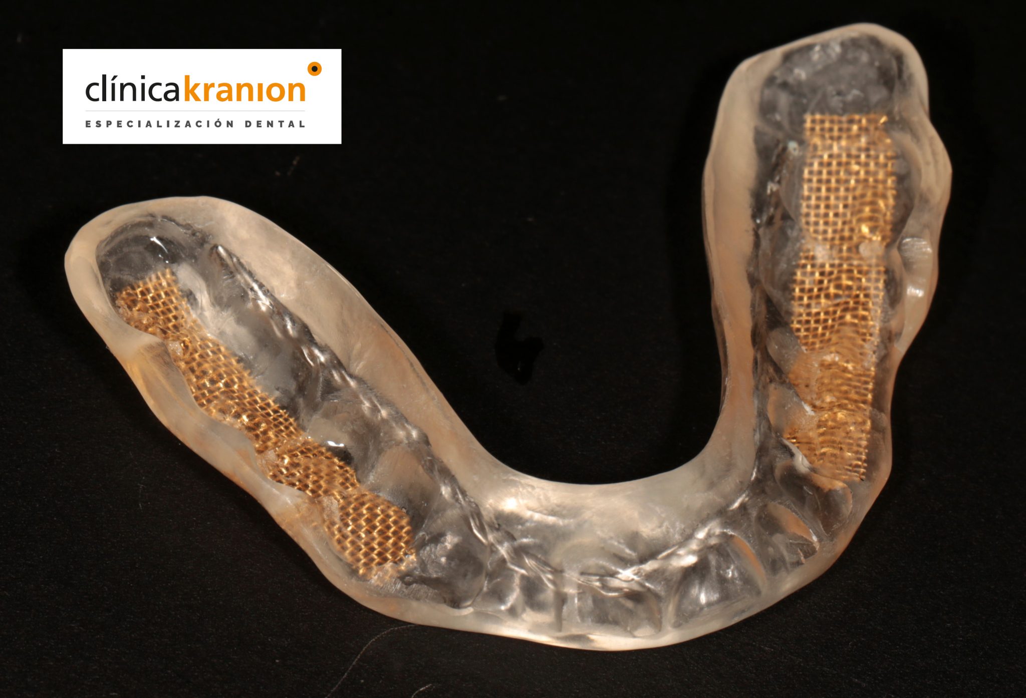 Férula de descarga - Clínica Kranion
