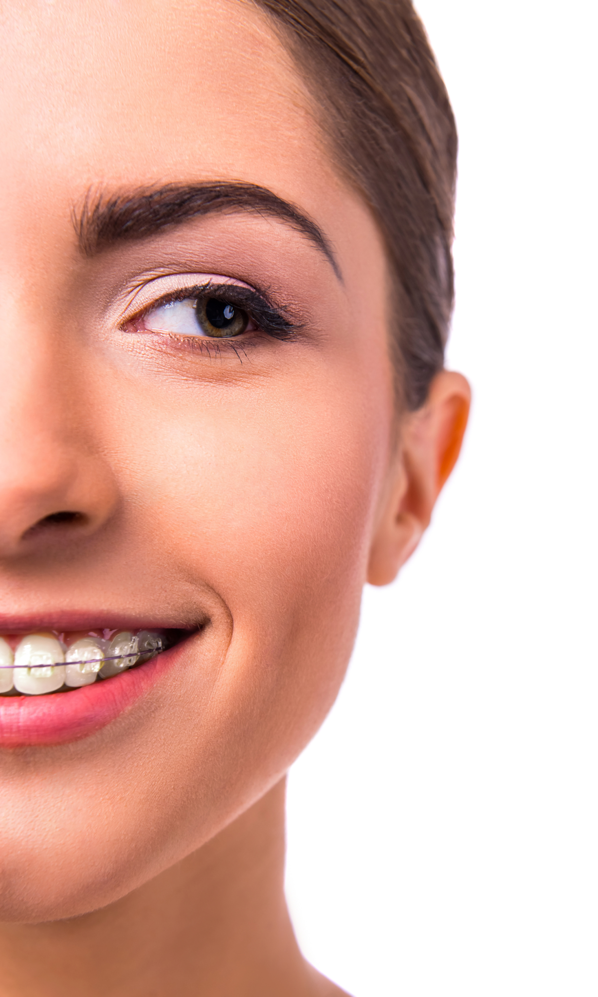 ¿Qué alimentos comer con brackets? - Clínica Kranion