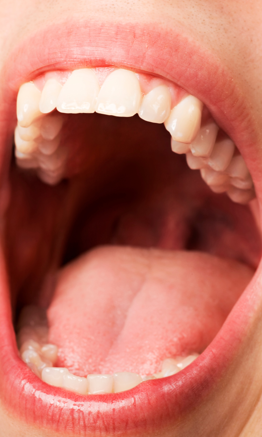 Lengua: enfermedades y lesiones frecuentes - Clínica Kranion