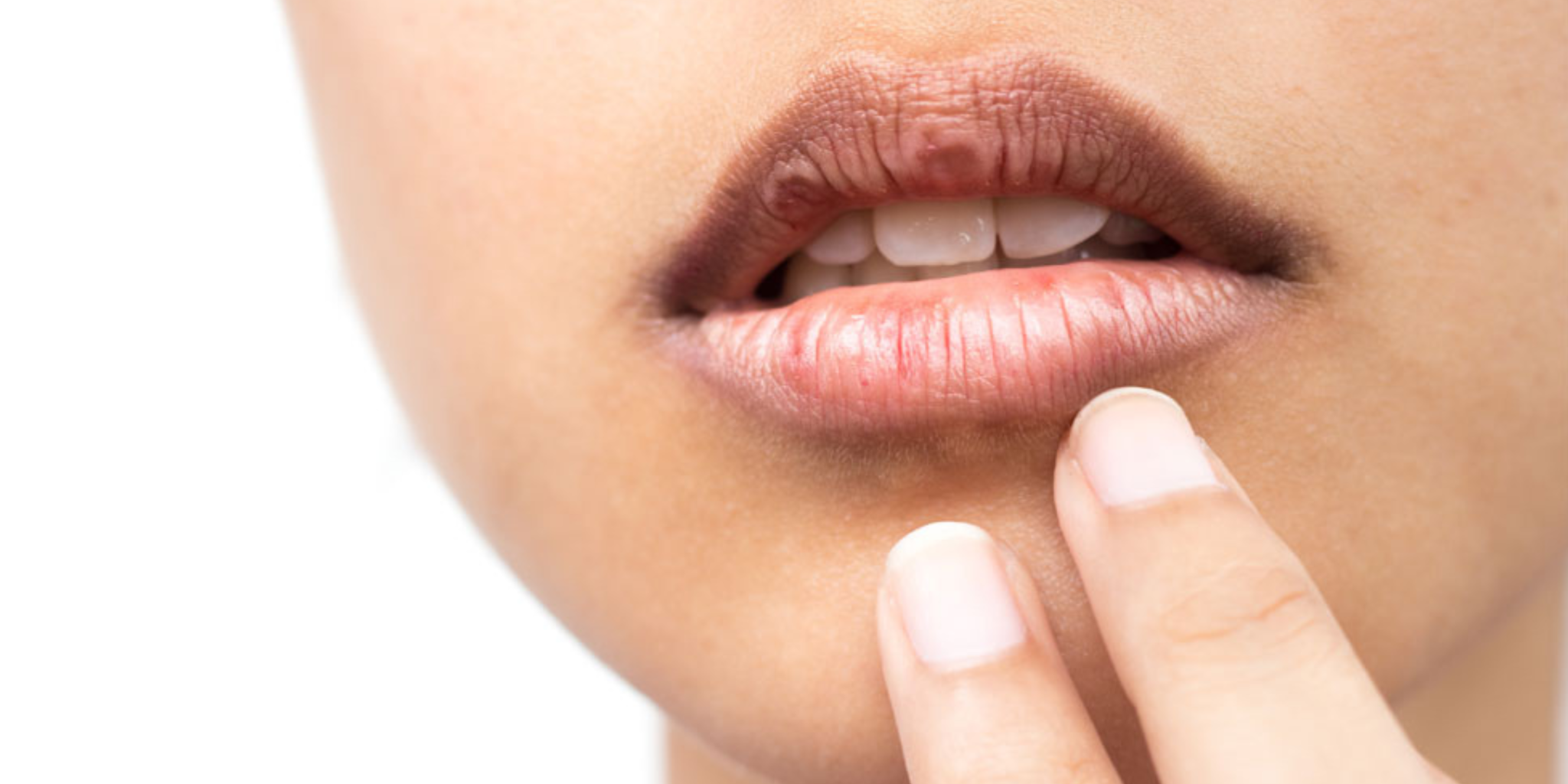 Glosario de términos odontológicos - Clínica Kranion