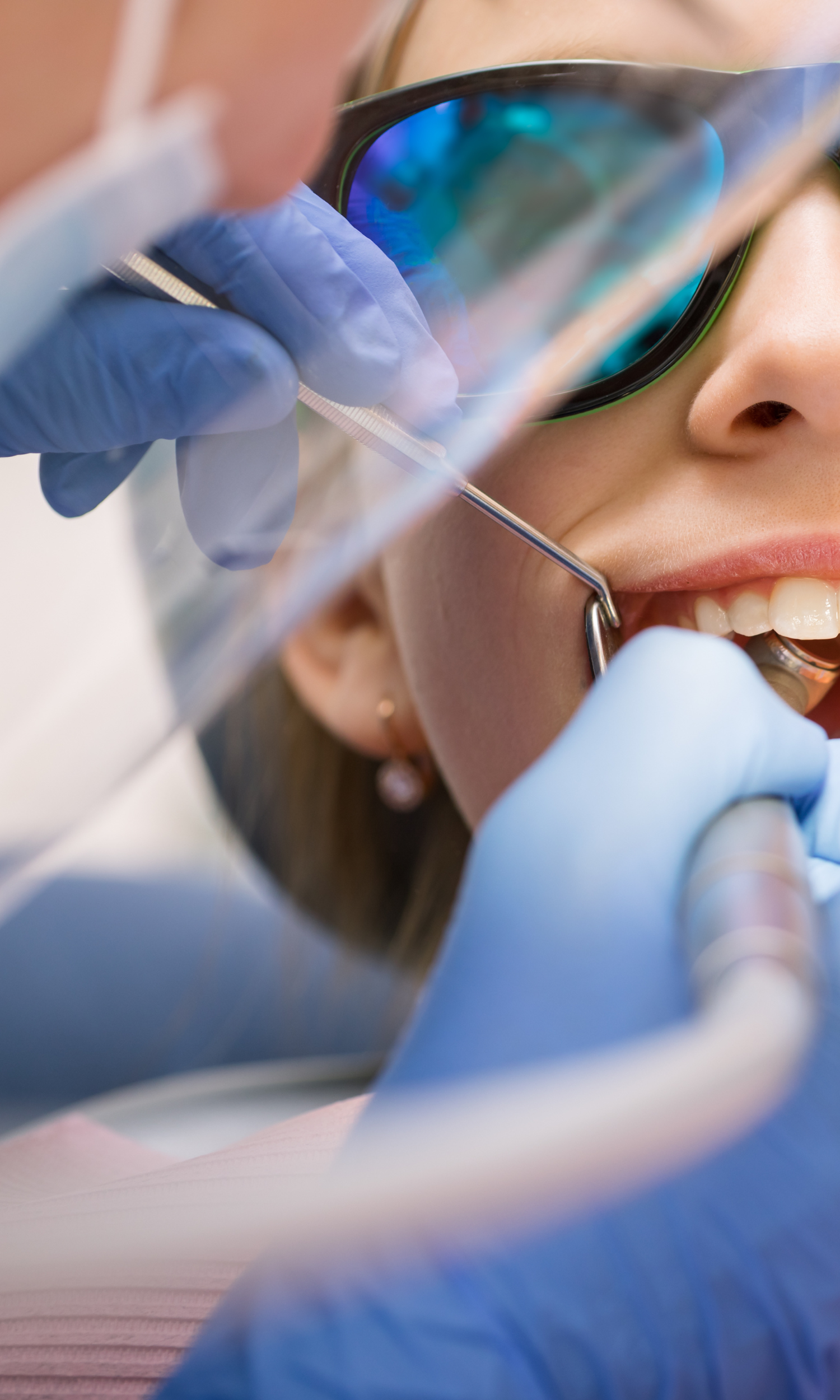 Empaste Dental: Cuidando tu Sonrisa - Clínica Kranion